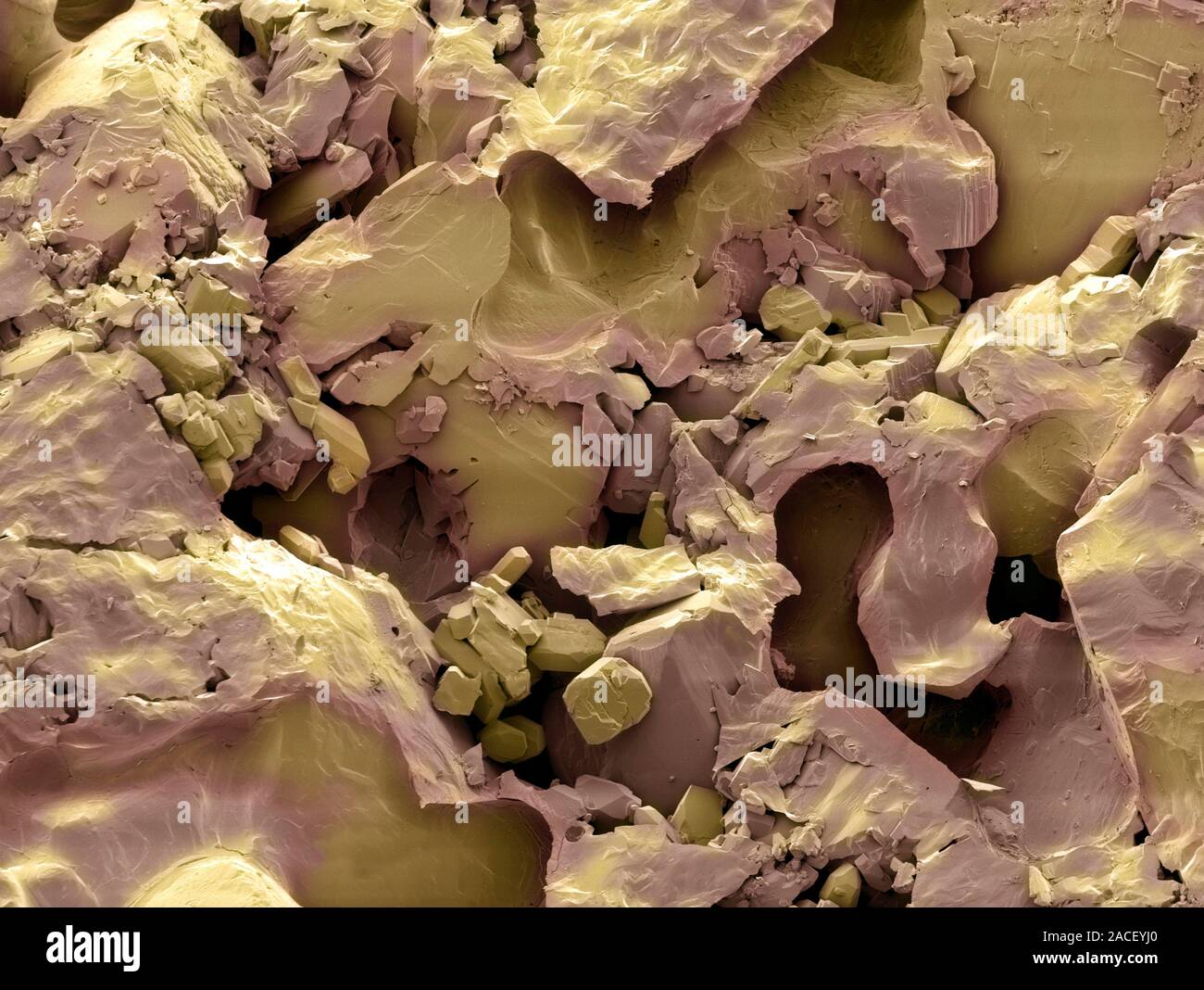 Sugar cube crystals. Coloured scanning electron micrograph (SEM) of a ...