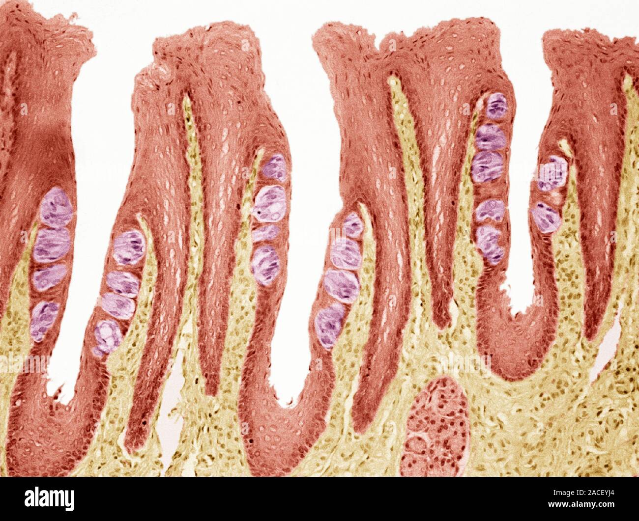 Taste buds. Coloured light micrograph of a section through the tongue ...