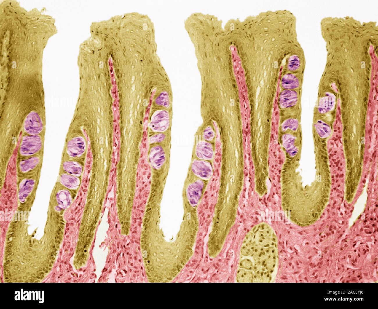Taste buds. Coloured light micrograph of a section through the tongue ...
