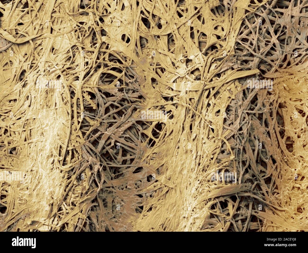 Tea bag fibres. Coloured scanning electron micrograph (SEM) of the ...