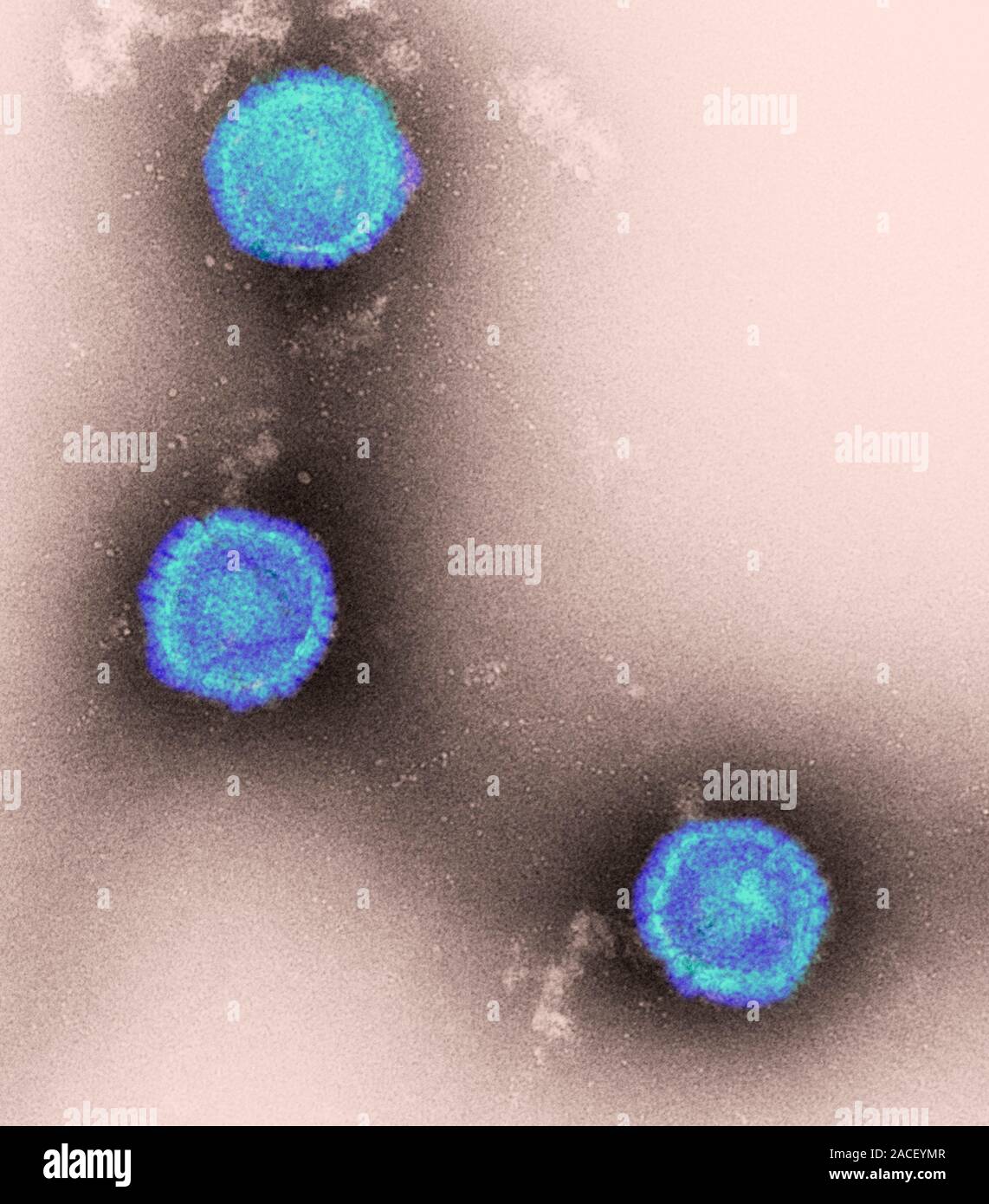 Herpes virus particles, coloured transmission electron micrograph (TEM ...
