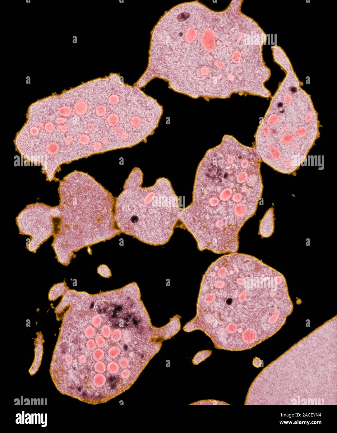 Blood platelets. Coloured transmission electron micrograph (TEM) of a ...