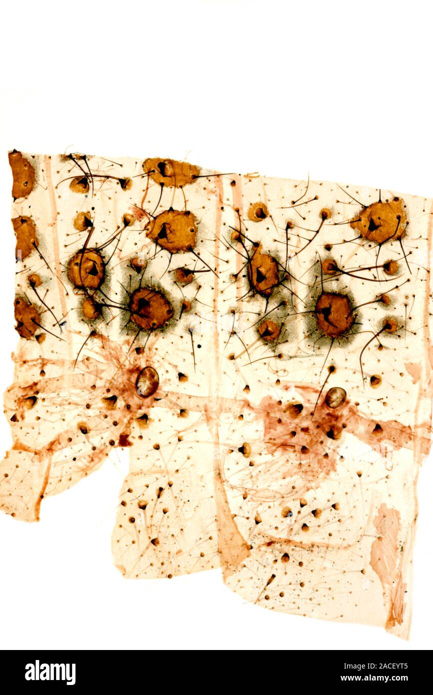 Caterpillar skin, light micrograph. This section of part of the skin ...