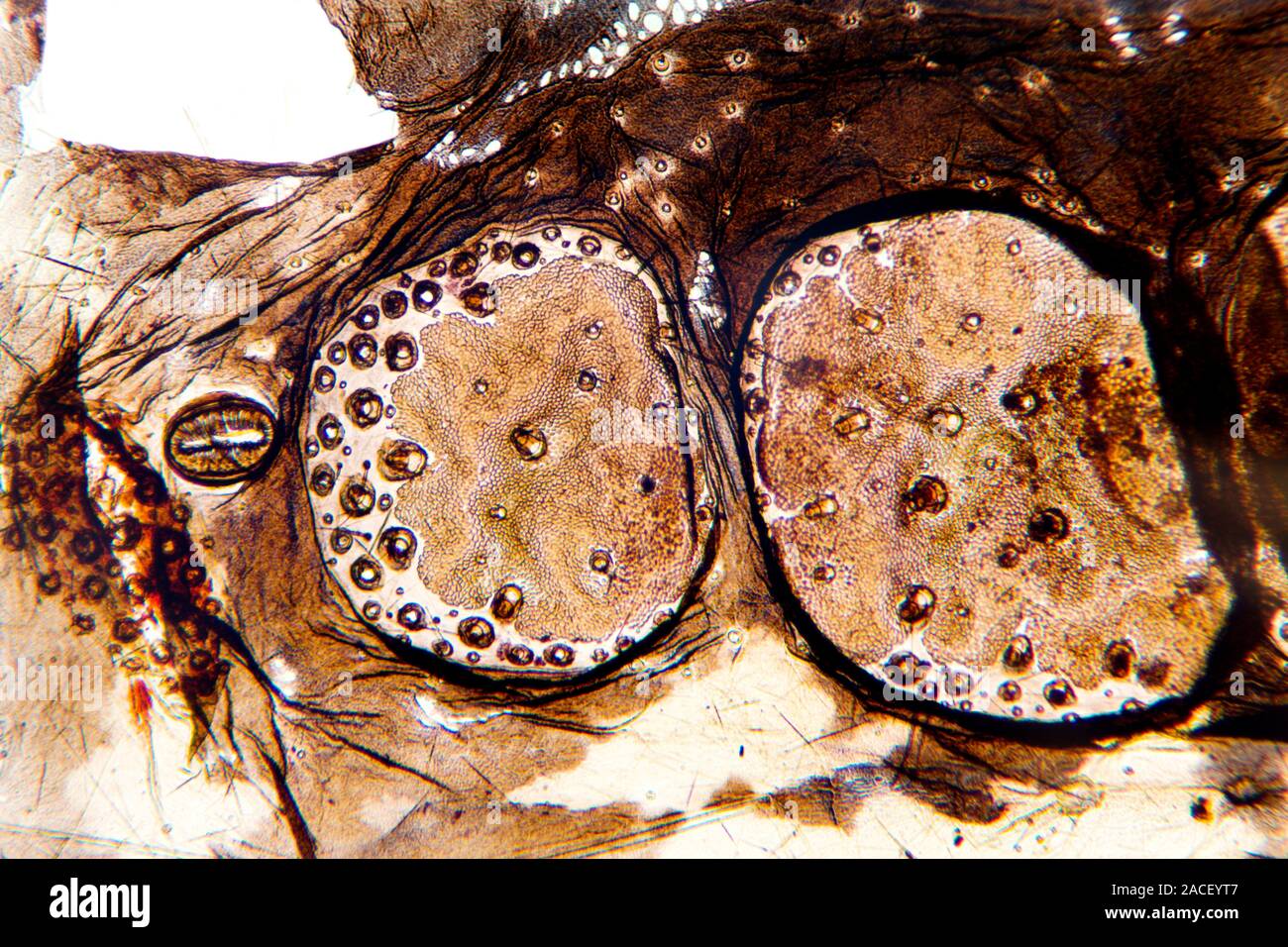Caterpillar skin, light micrograph. This section of the skin shows two ...