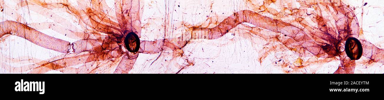 Caterpillar spiracles. Light micrograph of part of the skin of a ...