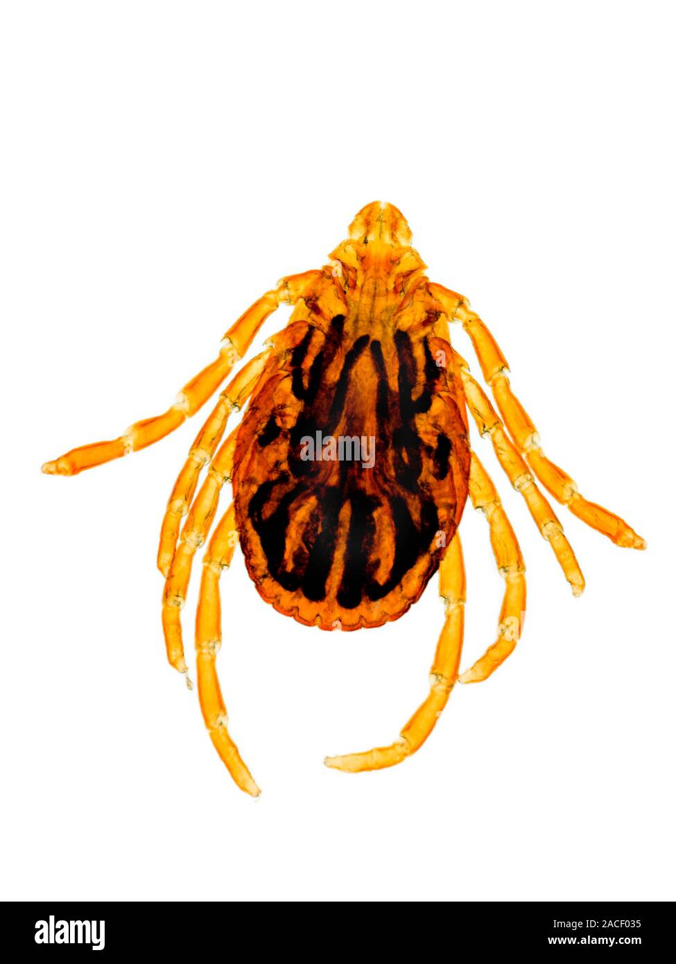 Common sheep tick (Ixodes ricinus), light micrograph. The sheep tick is ...