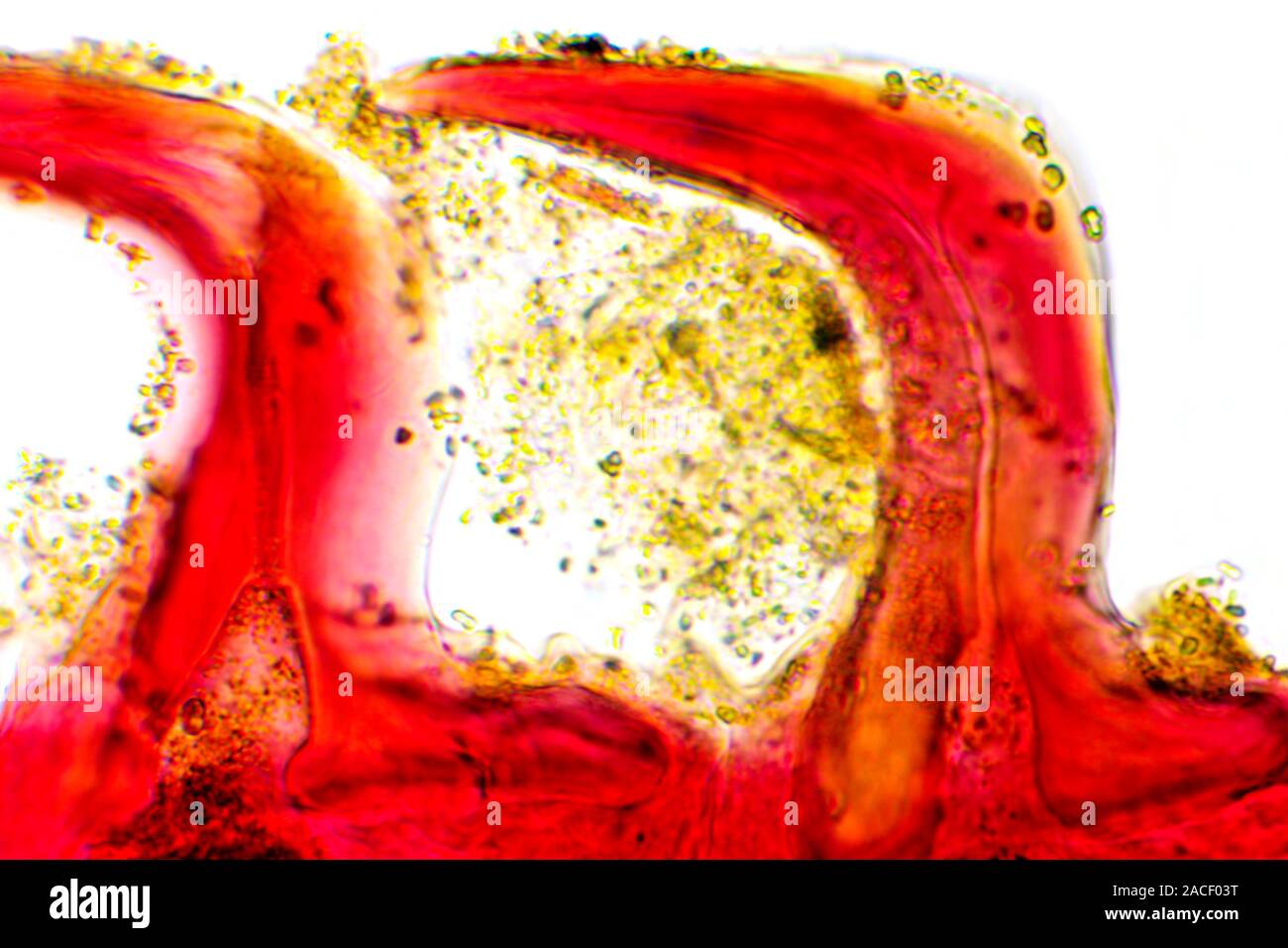 Shark skin. Light micrograph of a section through the skin of a shark ...