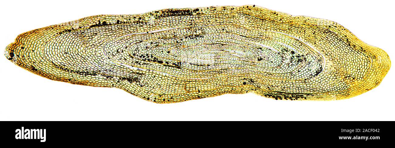 Eel scale. Light micrograph of a scale from the skin of an eel ...
