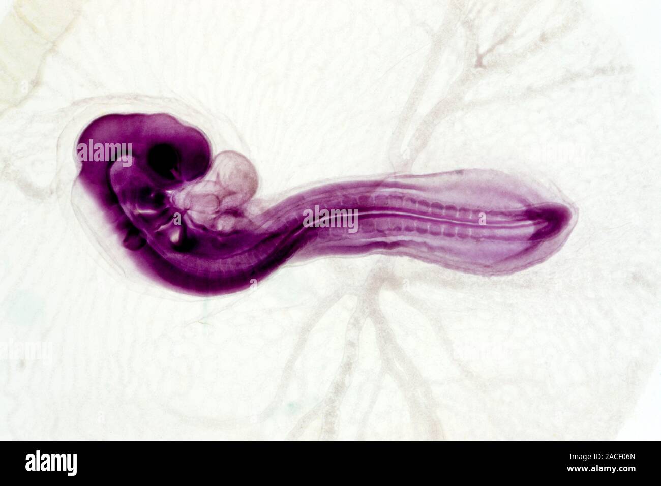 Chicken embryo. Light micrograph of the embryo of a chicken (Gallus ...