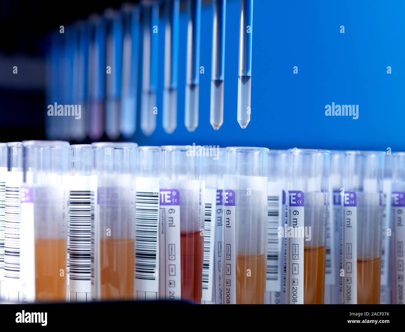 Blood screening. Blood plasma samples being dispensed by an automated ...