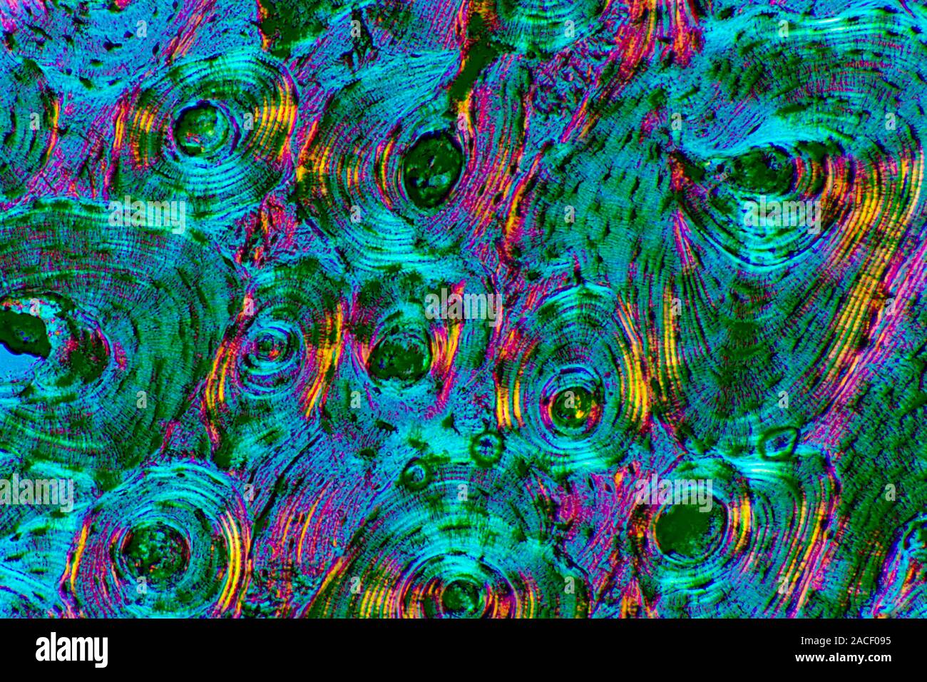 Compact bone. Polarised light micrograph of a transverse section ...