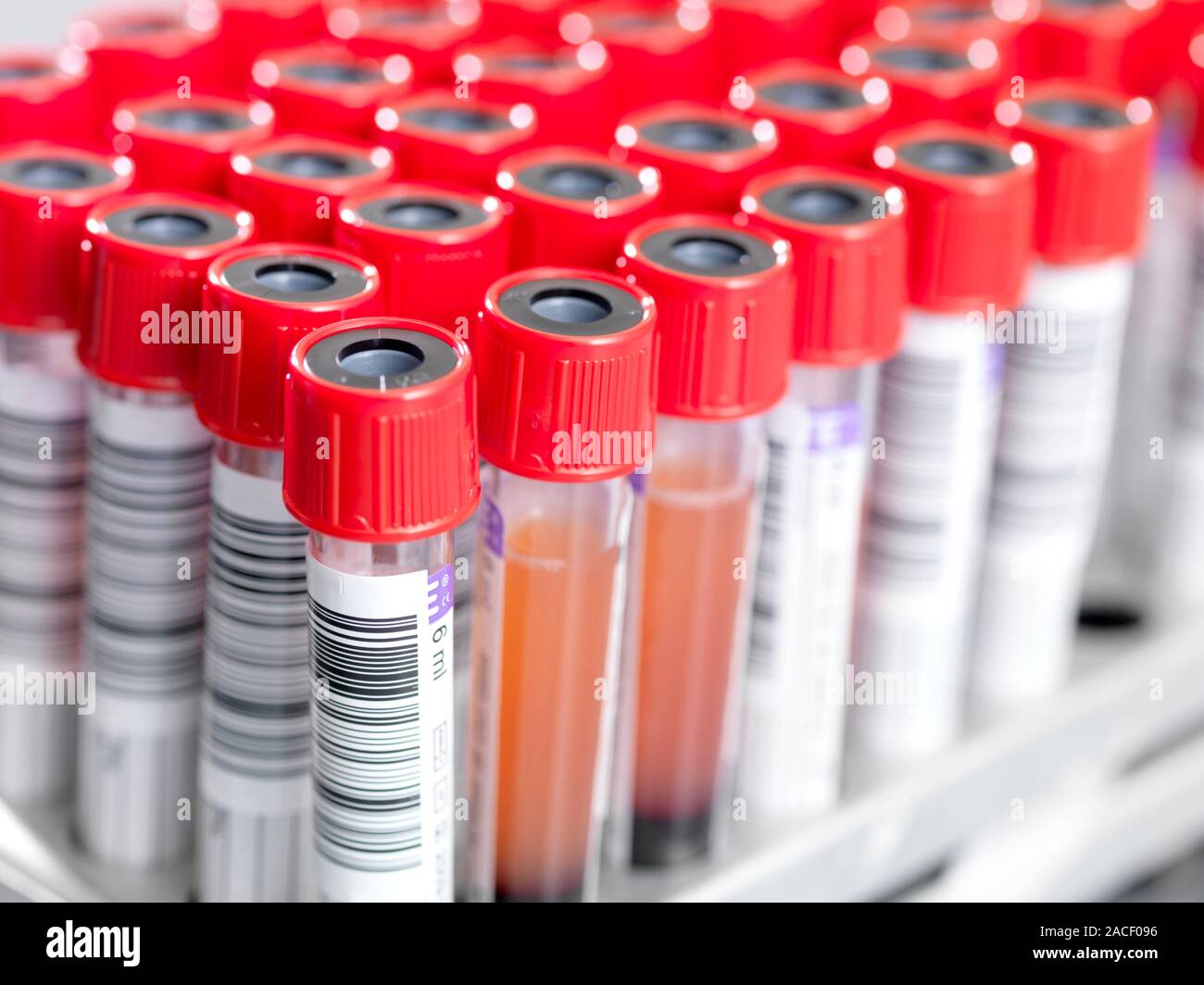 Blood samples. Blood sample tubes in a rack Stock Photo - Alamy