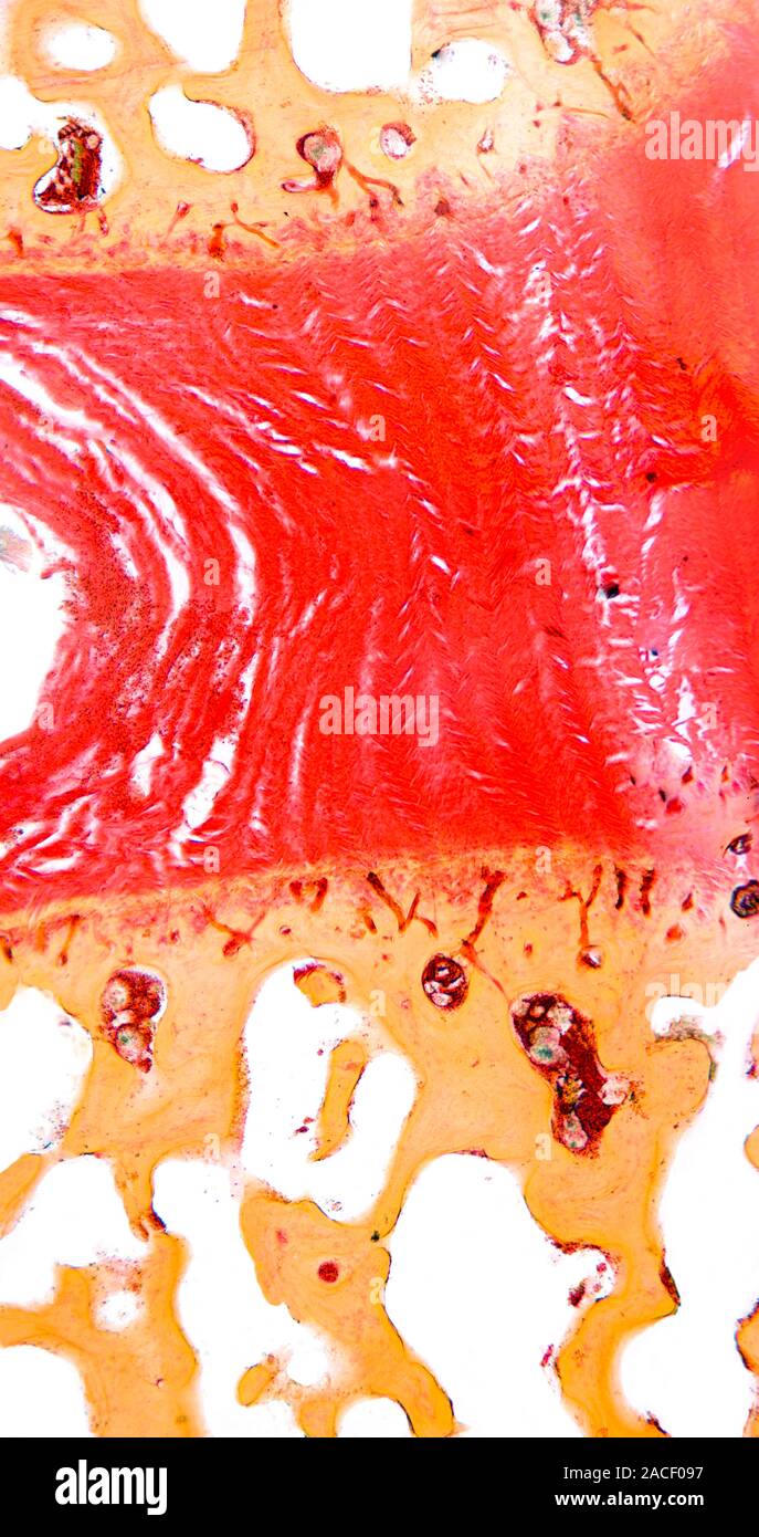 Intervertebral disc. Light micrograph of a transverse section through ...