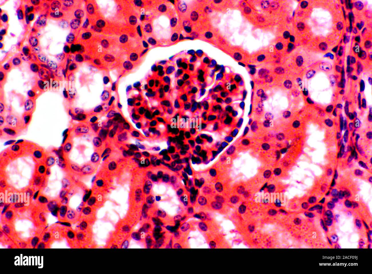 Kidney glomerulus, light micrograph. This section, from the cortex of ...