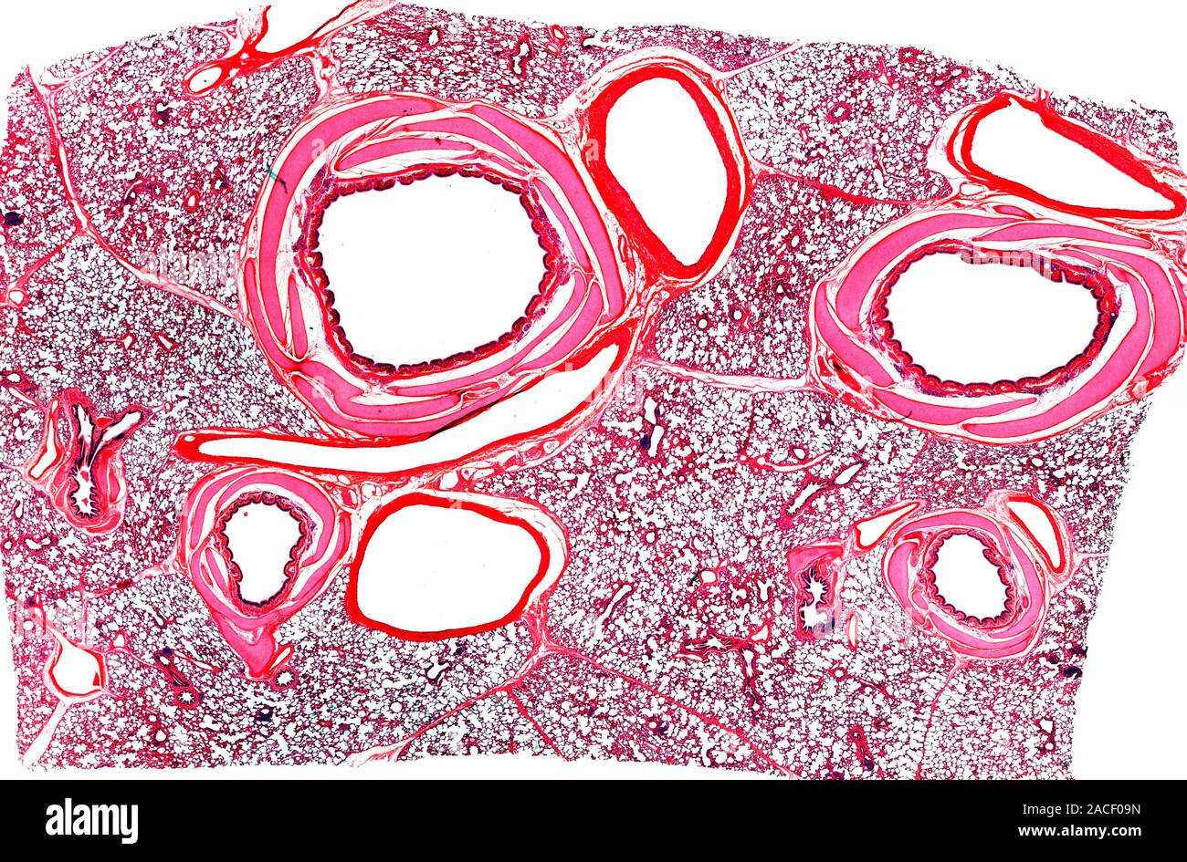 Lung tissue. Light micrograph of a transverse section through a ...