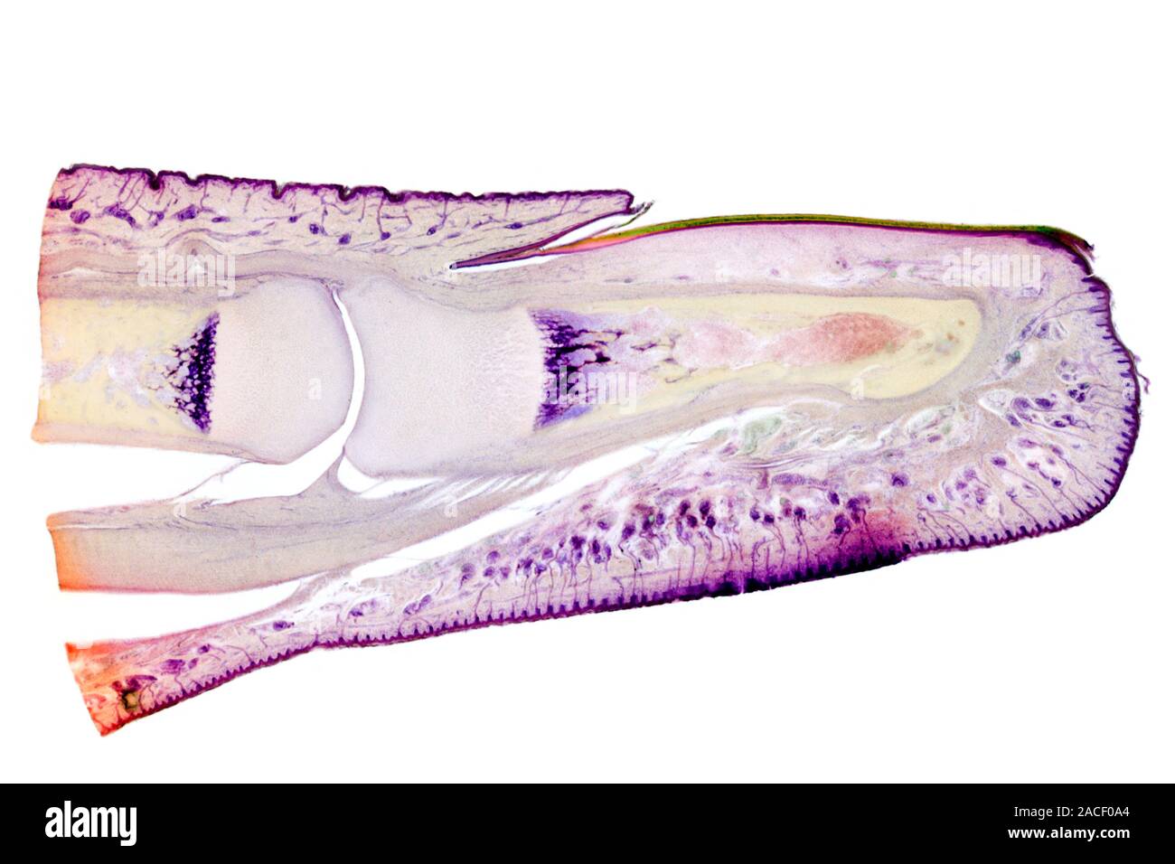 Human finger. Light micrograph of a longitudinal section through a ...