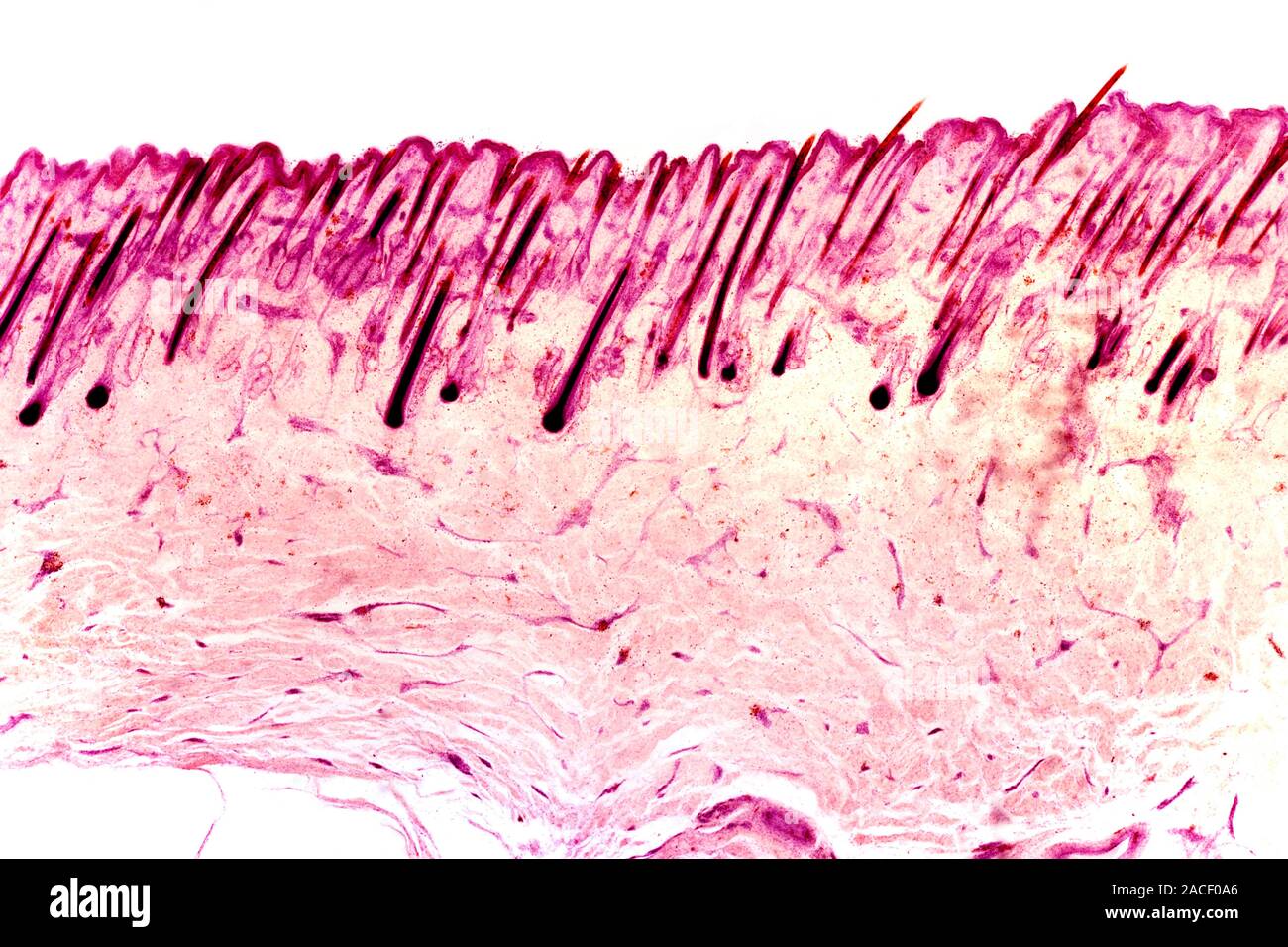Skin tissue. Light micrograph of a transverse section through human ...