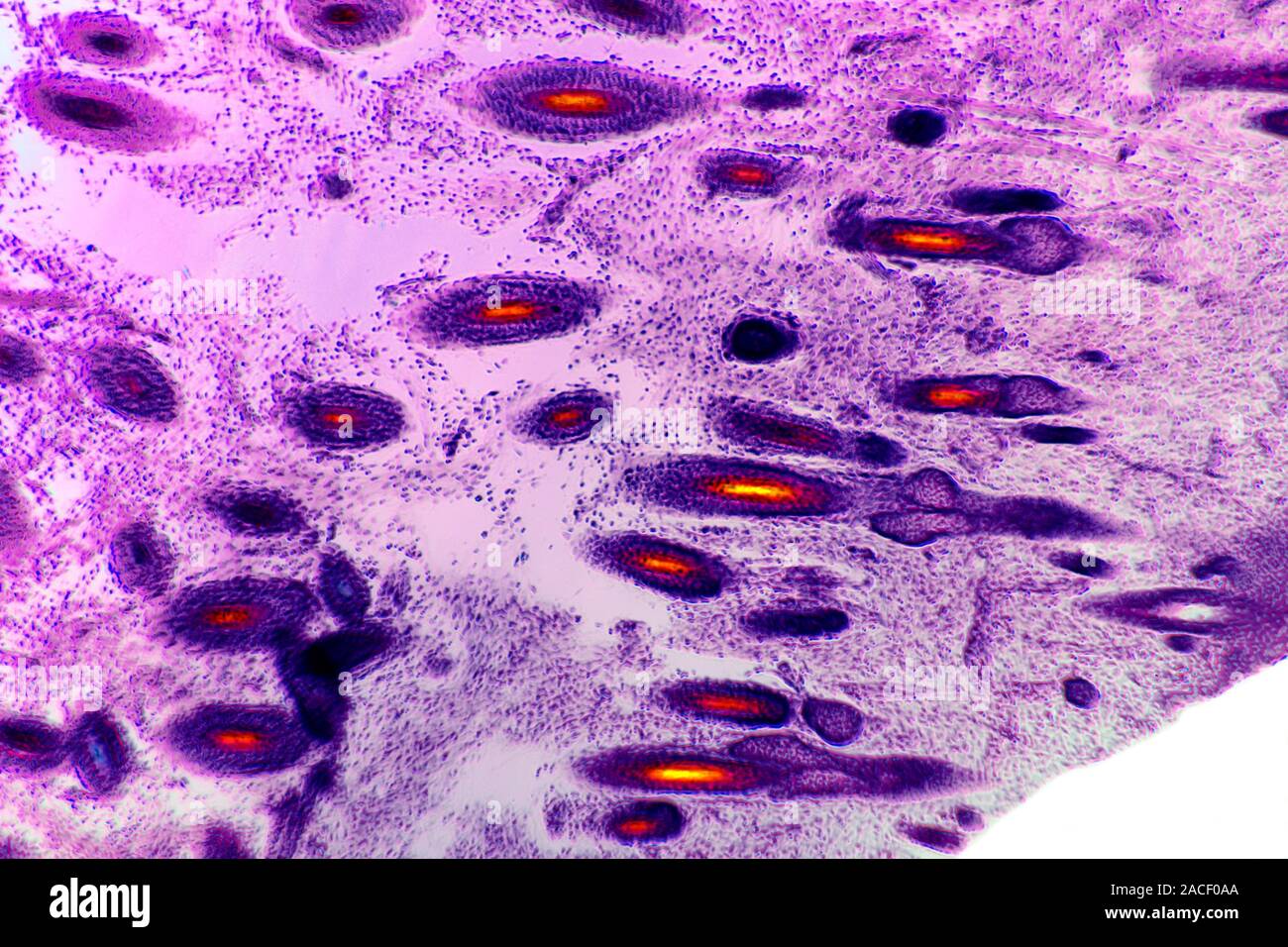 Scalp tissue. Polarised light micrograph of a section through the human ...