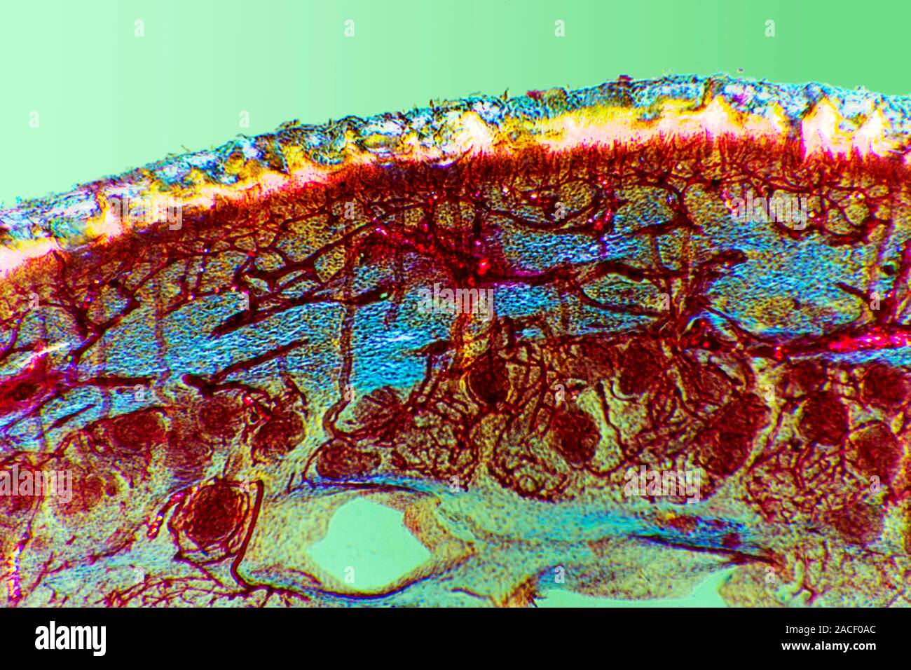 Foot skin tissue. Light micrograph of a transverse section through skin ...