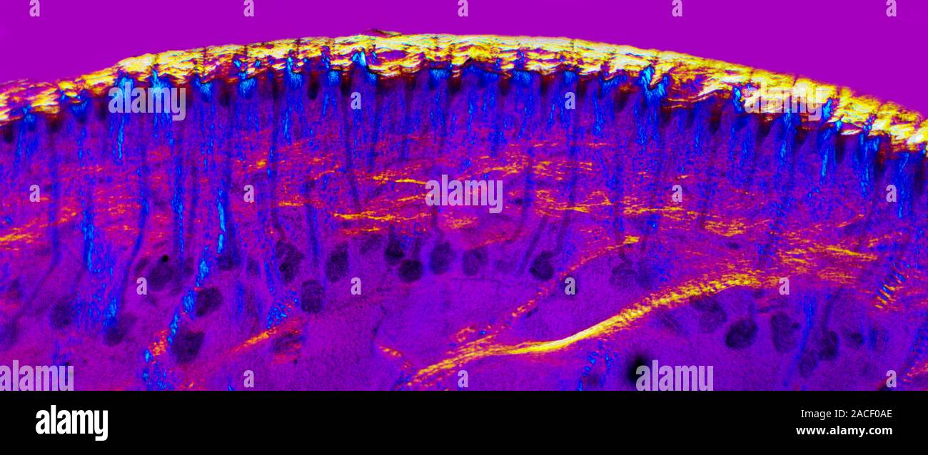 Skin sweat glands. Polarised light micrograph of a transverse section ...