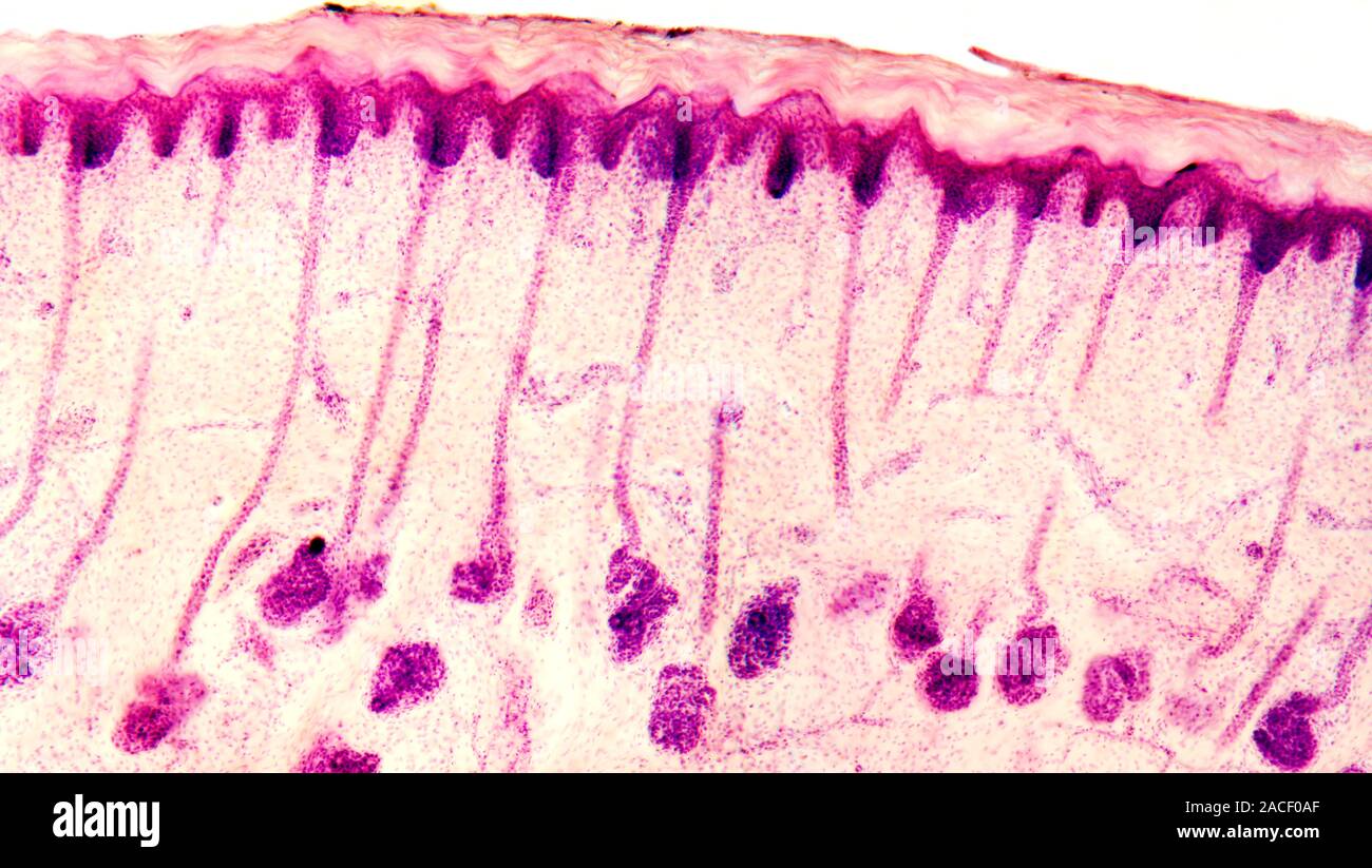 Skin sweat glands. Light micrograph of a transverse section through ...