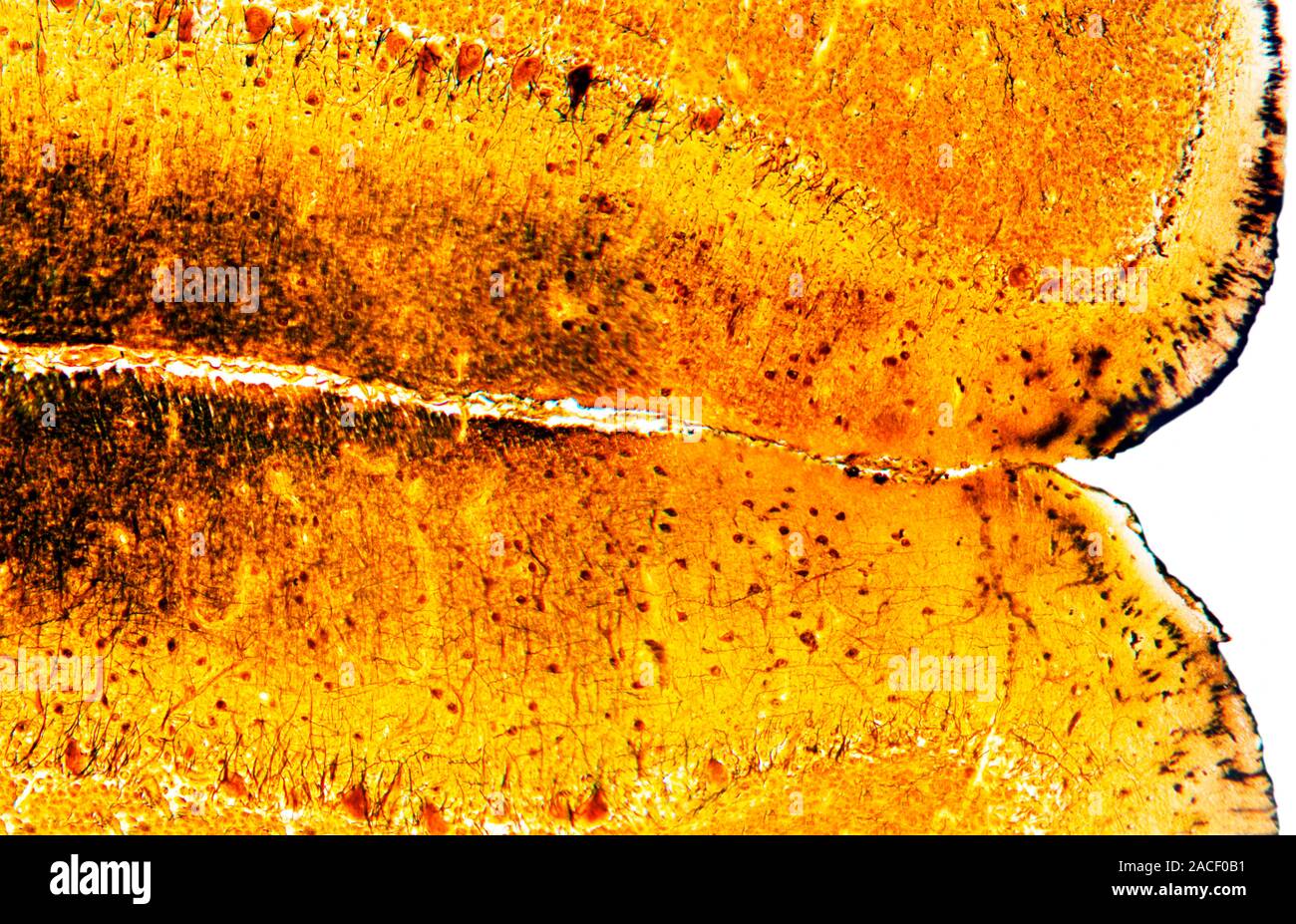 Brain tissue. Light micrograph of a section through tissue from the ...