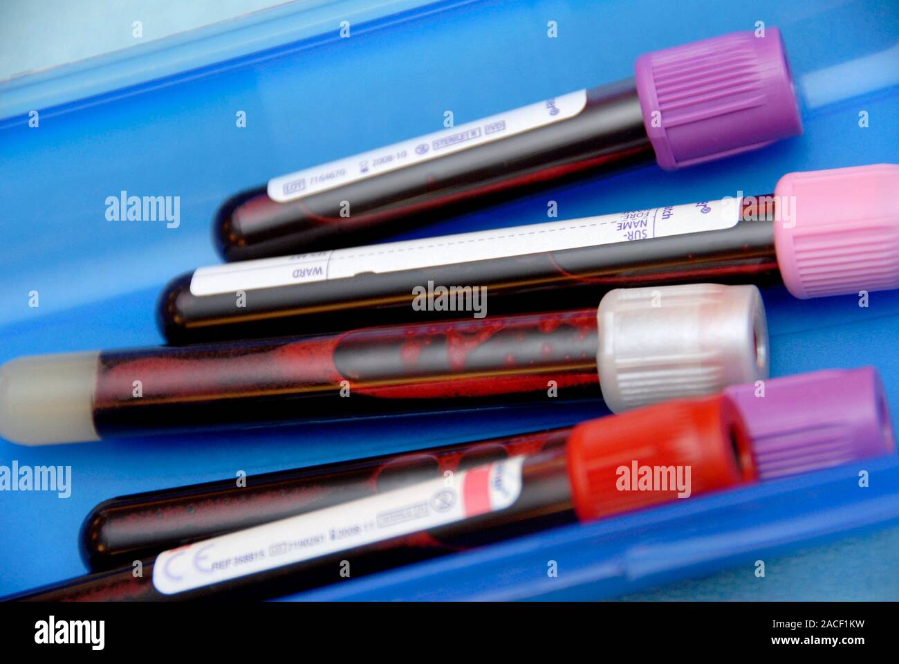 Blood samples in vacutainer tubes. The cap colours indicate the ...