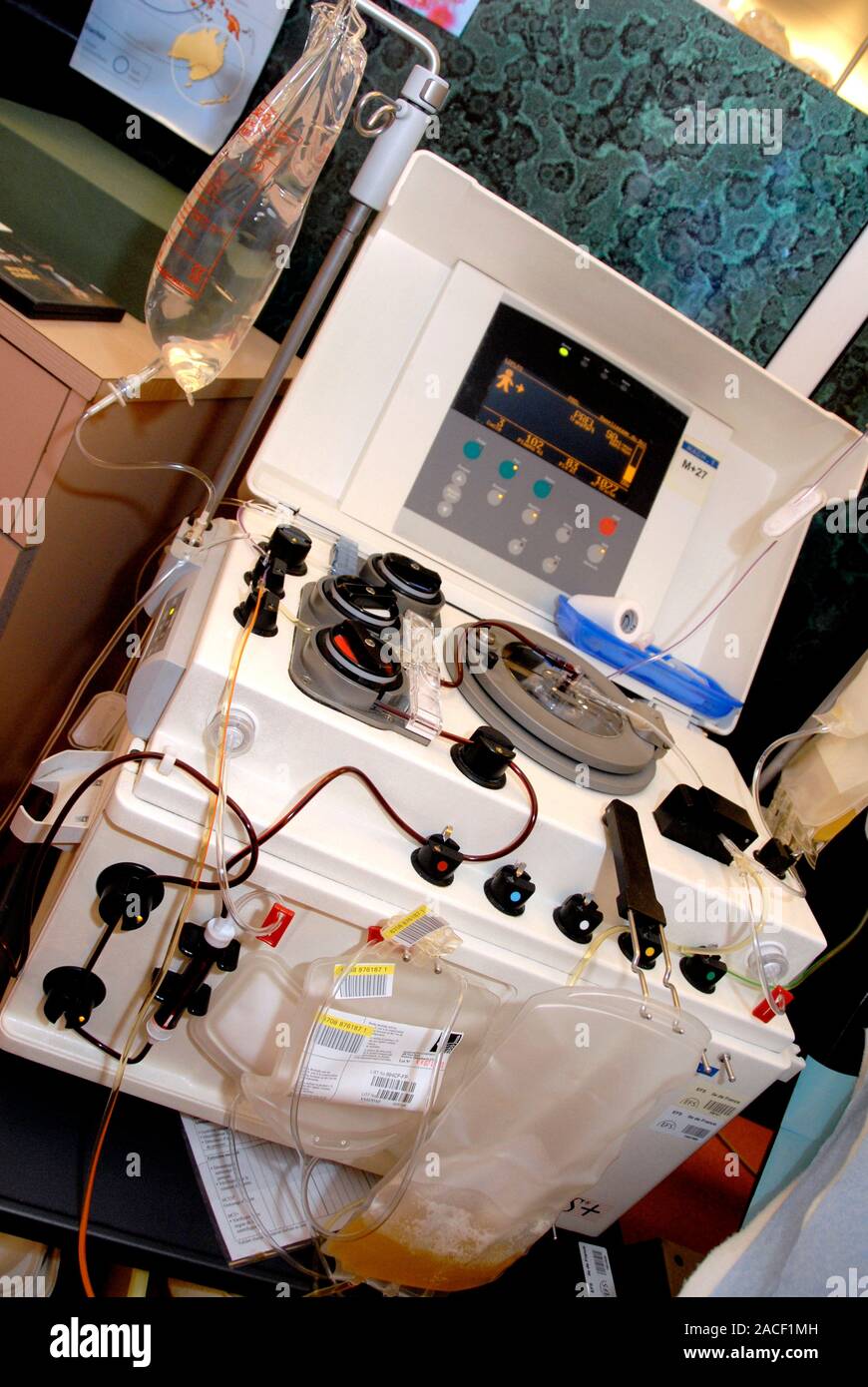 Apheresis machine. Apheresis is the process by which blood from a donor ...