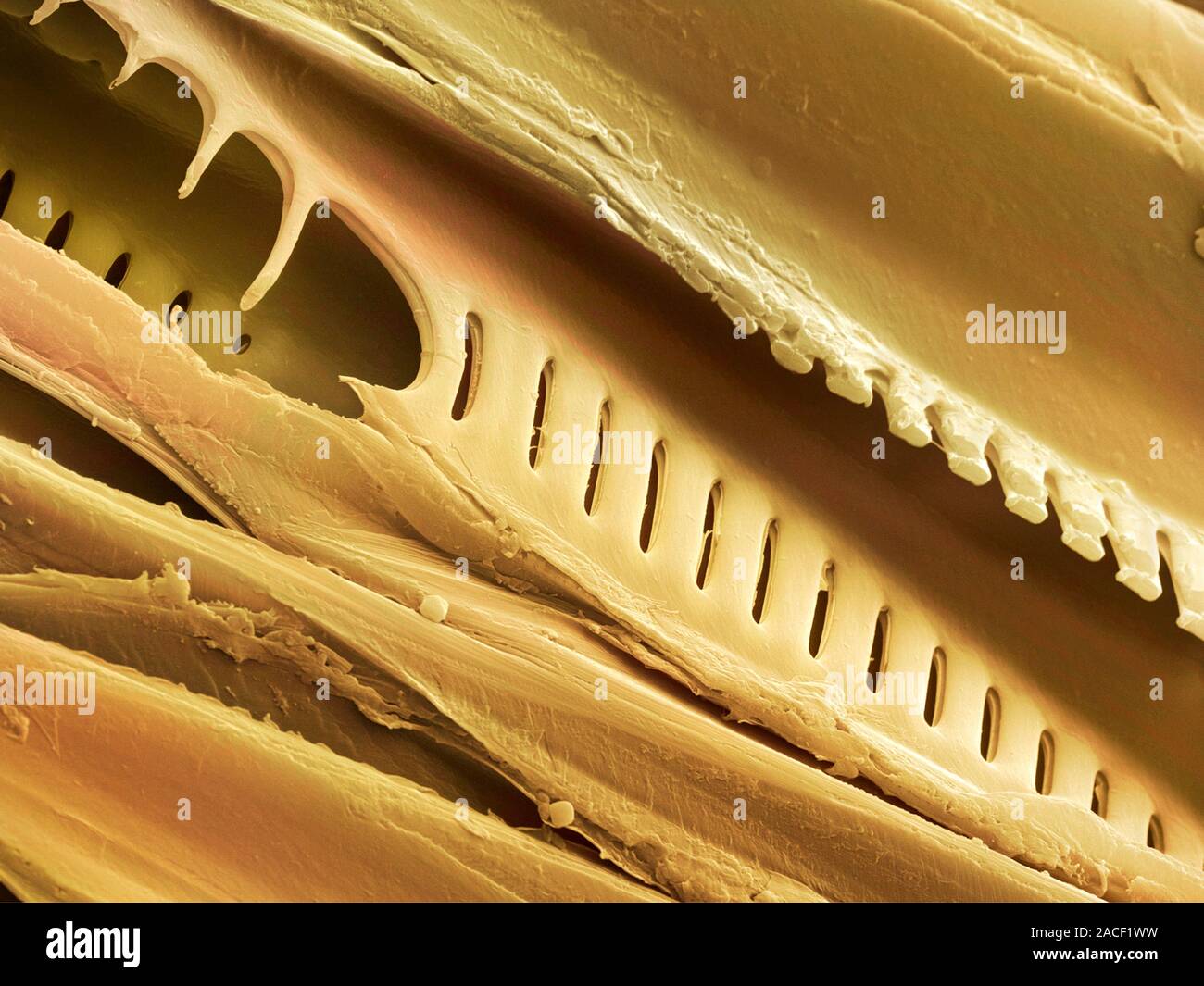 Xylem vessels, coloured scanning electron micrograph (SEM ...