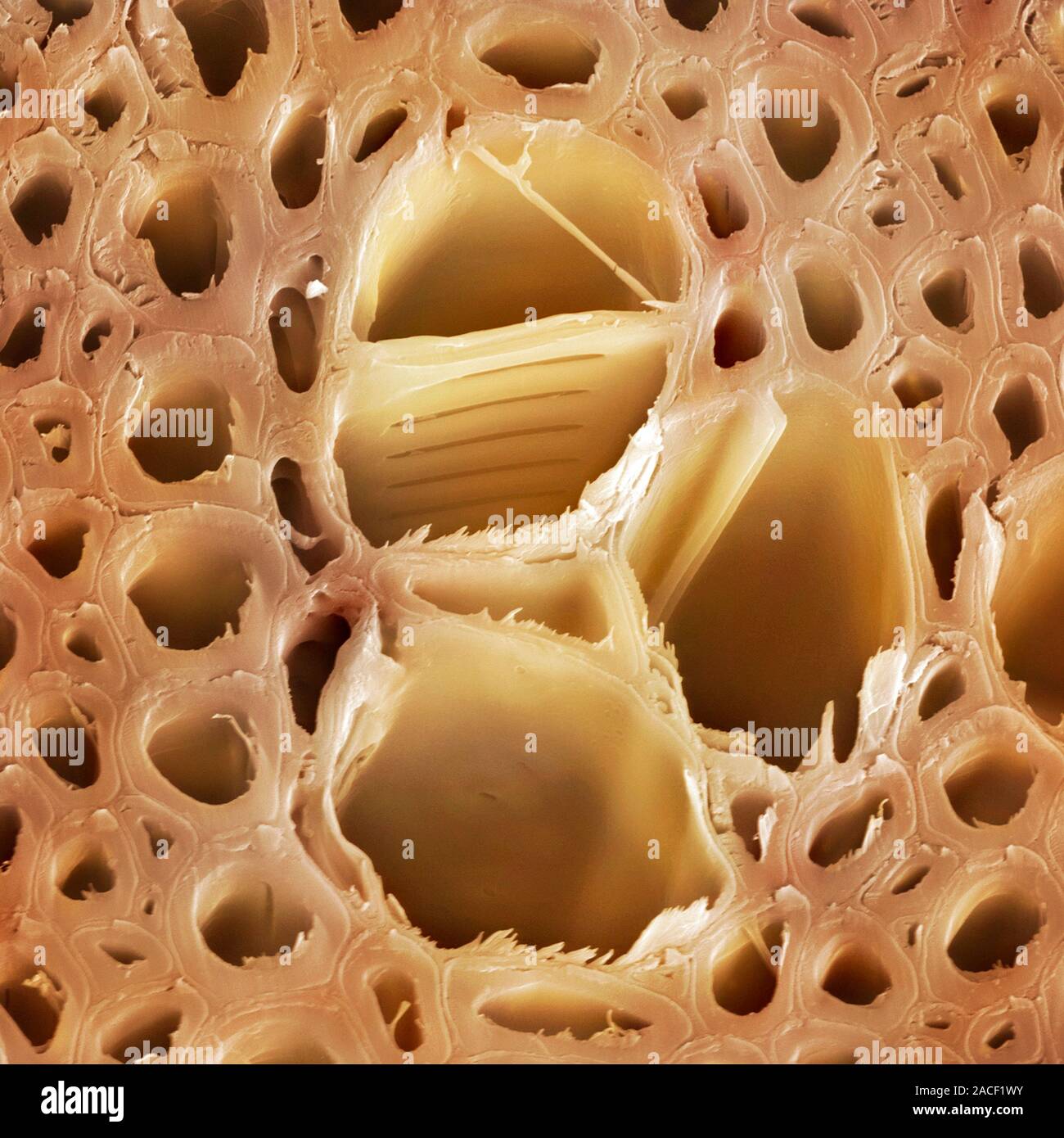Xylem vessels, coloured scanning electron micrograph (SEM). Cross ...