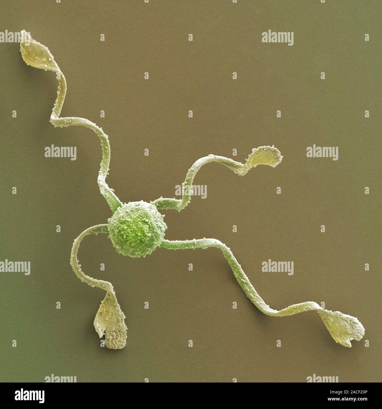 Horsetail spore. Coloured scanning electron micrograph (SEM) of a spore ...