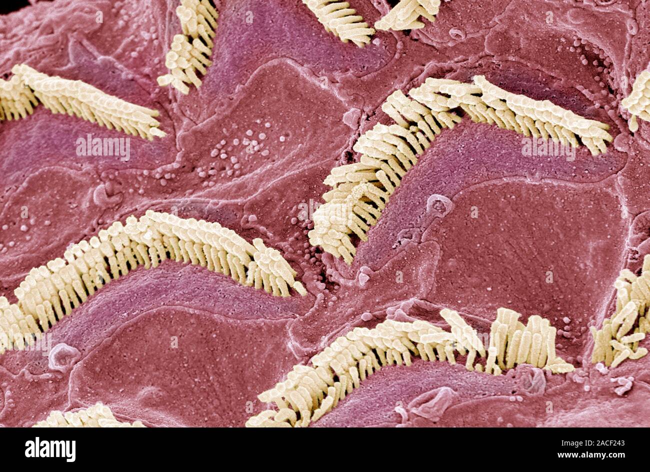 Inner ear hair cells. Coloured scanning electron micrograph (SEM) of ...