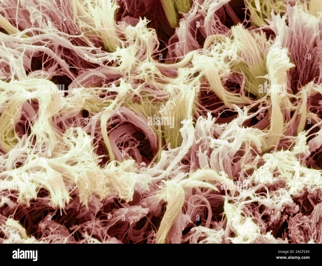 Collagen fibres, coloured scanning electron micrograph (SEM). Collagen ...