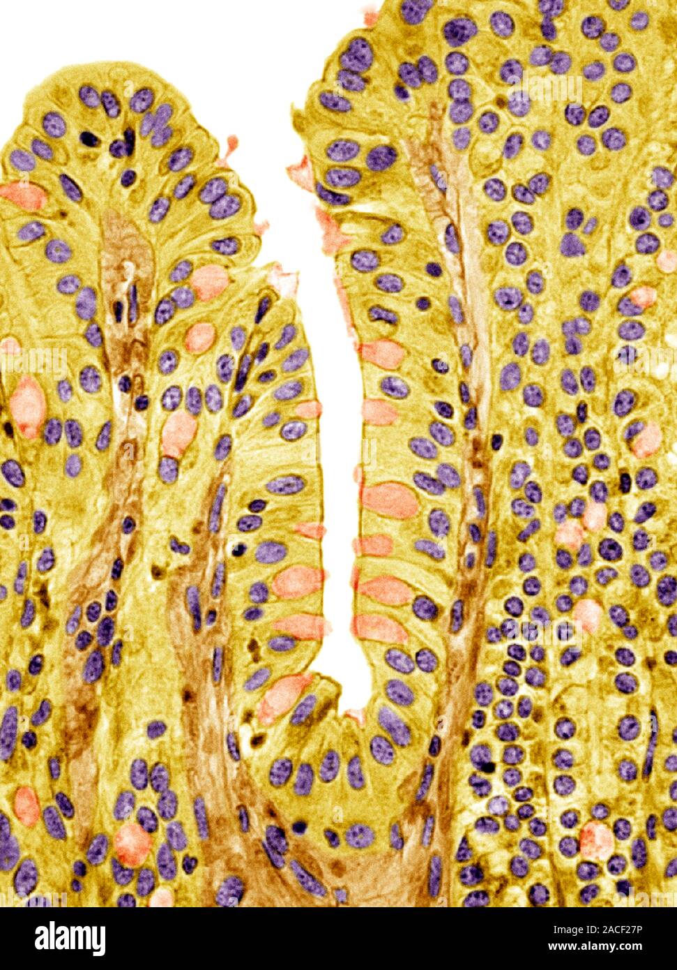 Small intestine lining. Light micrograph of a section through the ...