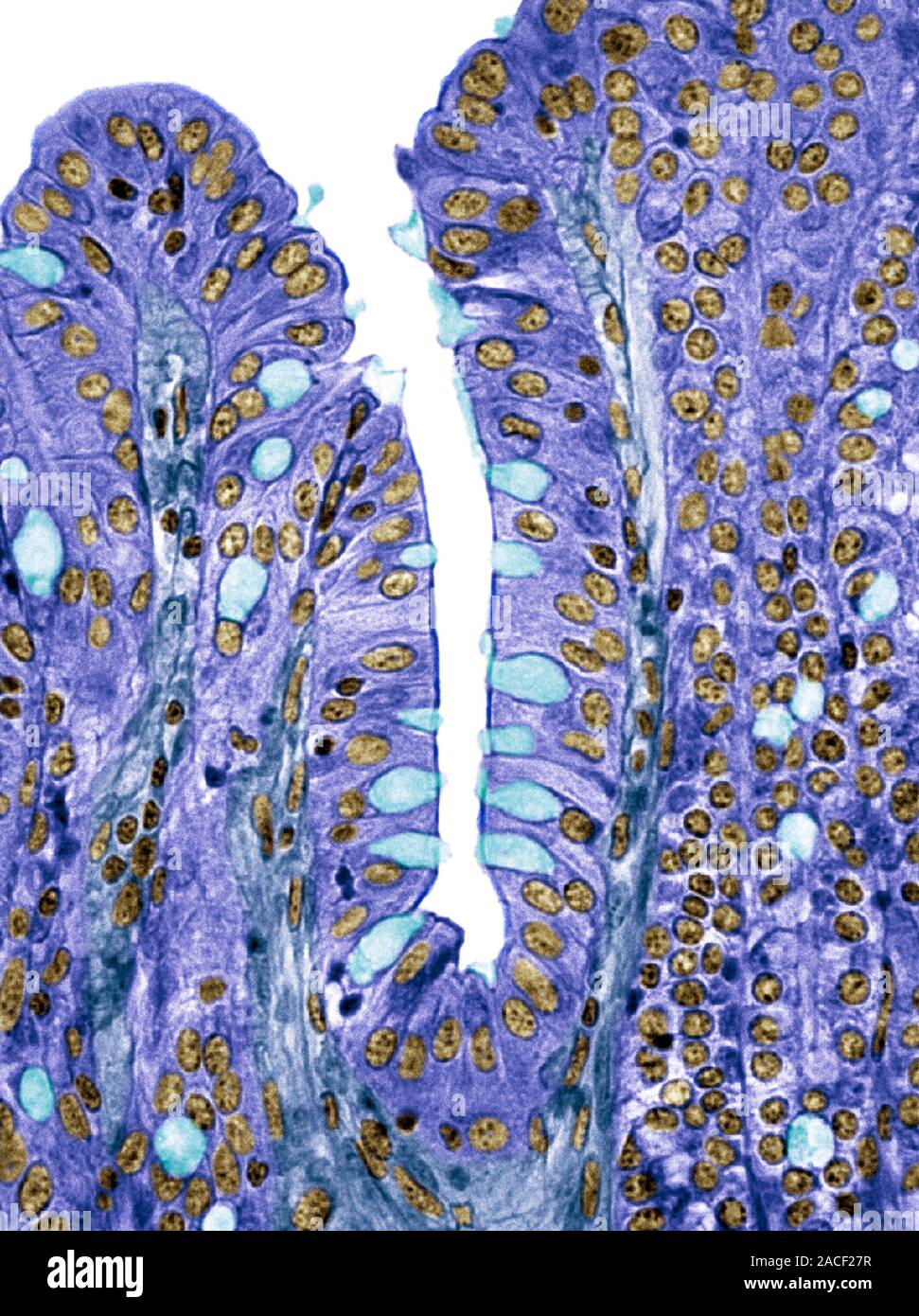 Small intestine lining. Light micrograph of a section through the ...