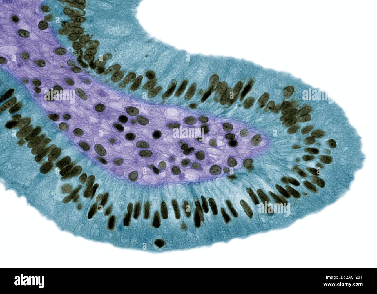 Gall bladder surface. Coloured light micrograph of a section through a ...