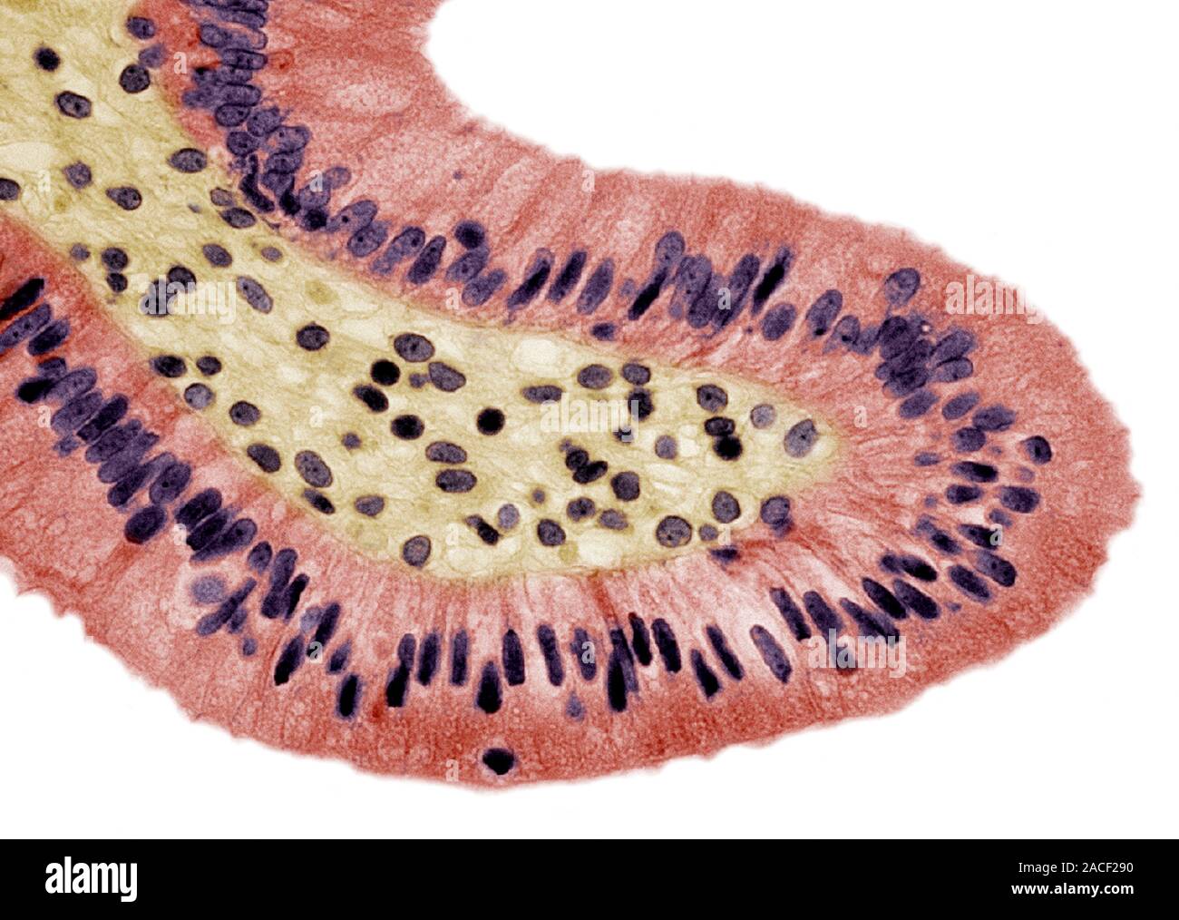 Gall bladder surface. Coloured light micrograph of a section through a ...