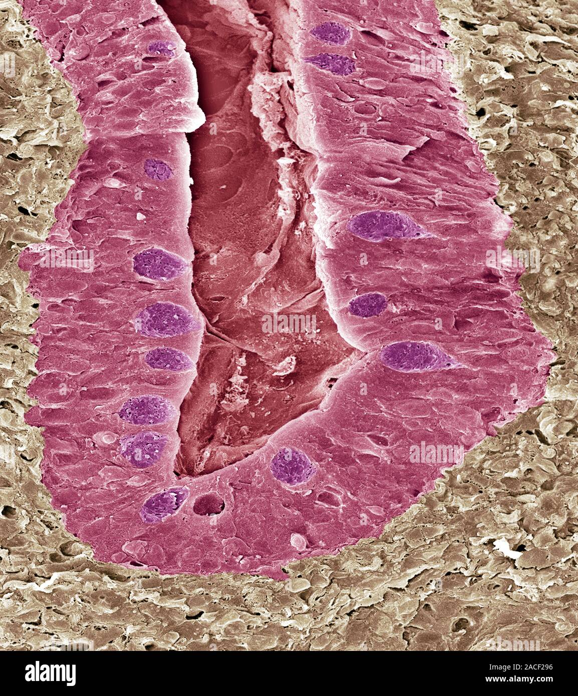 Intestinal lining. Coloured scanning electron micrograph (SEM) of a ...