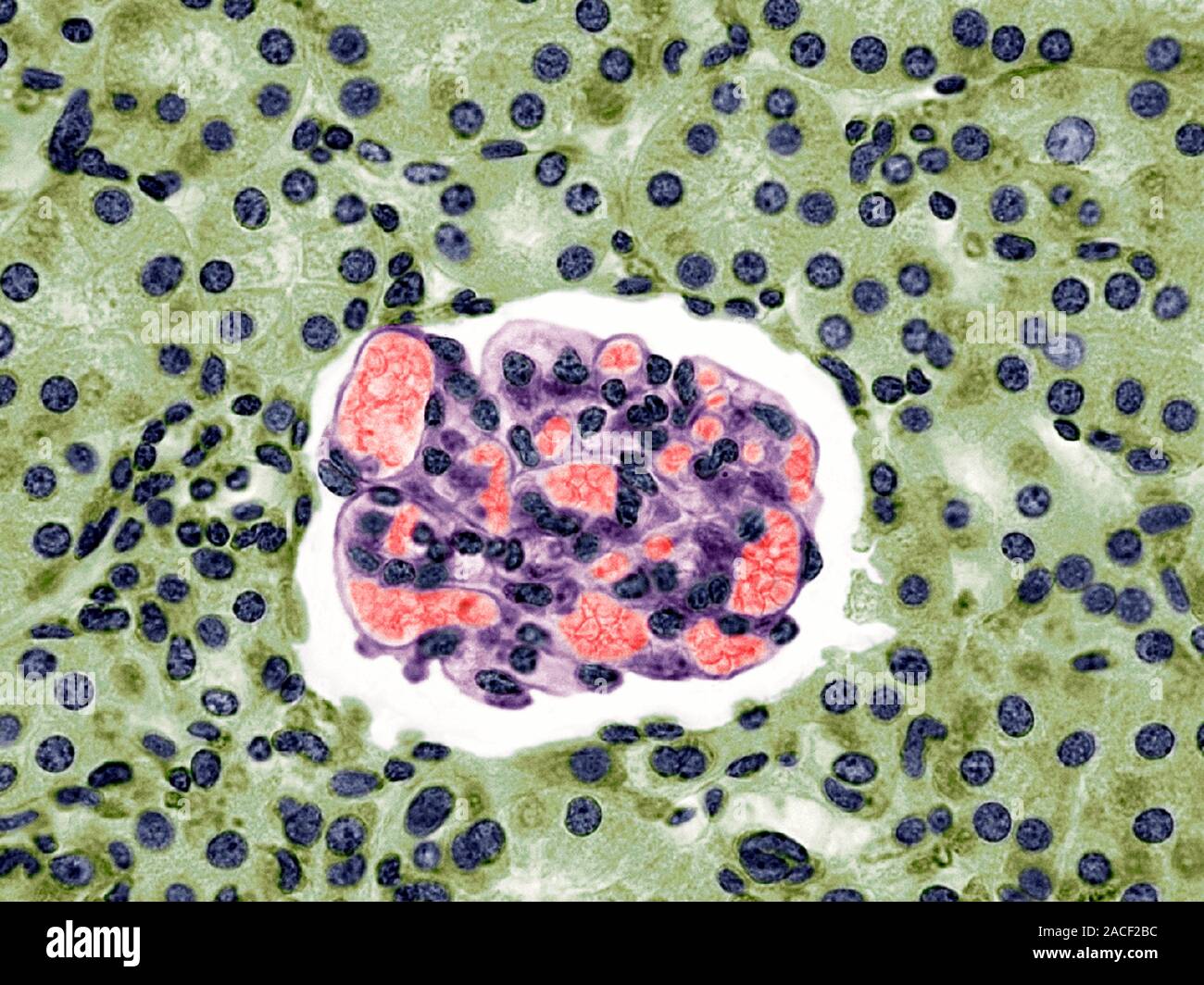 Kidney glomerulus. Coloured light micrograph of a section through the ...