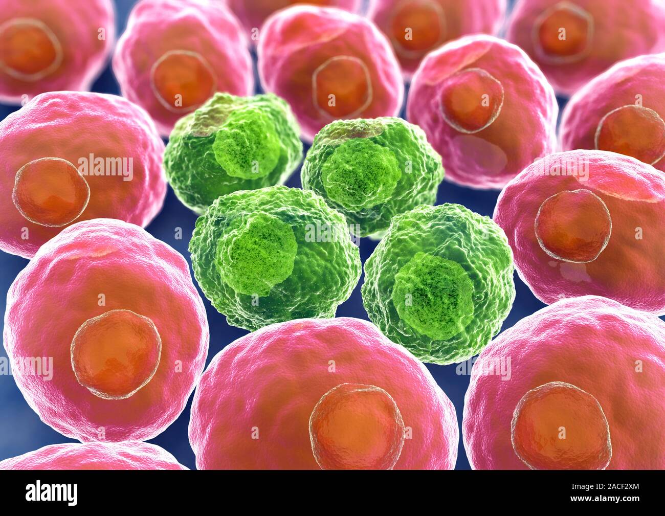 Cancer cells. Computer artwork of cancer cells (green) surrounded by ...