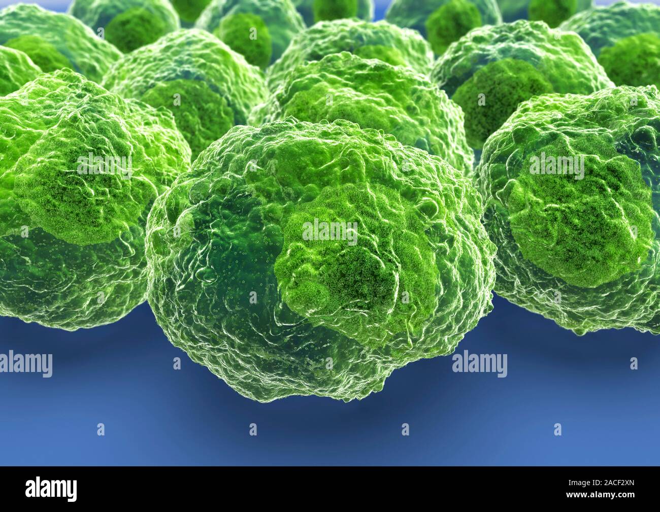 Cancer cells (green), computer artwork. Cancer cells divide rapidly in ...