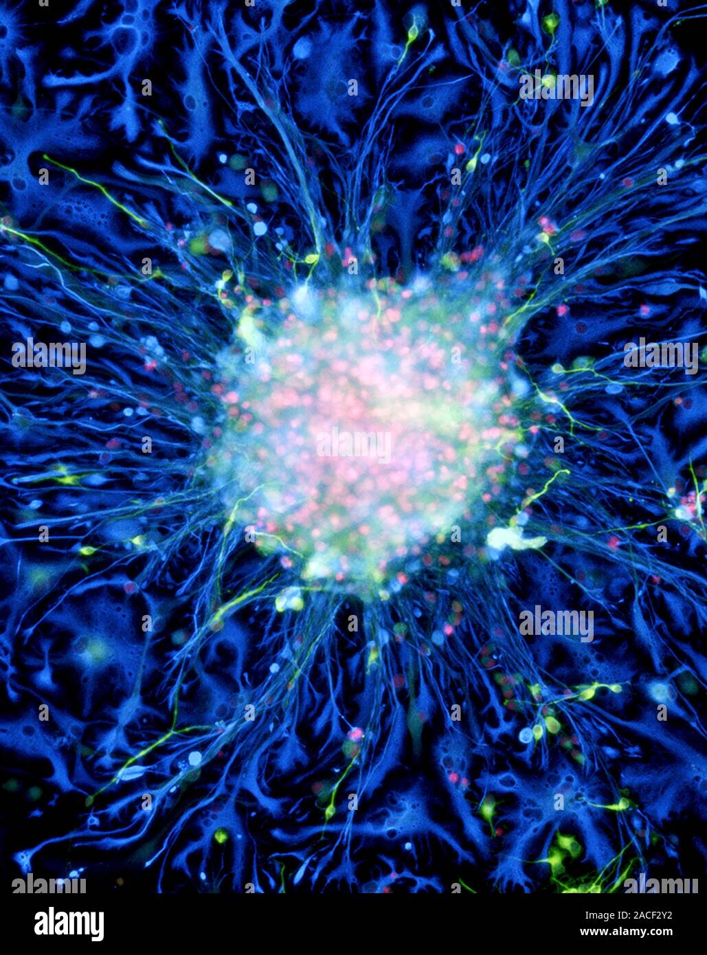 Neural Stem Cell Culture Fluorescent Light Micrograph Of A Group Of Neural Stem Cells
