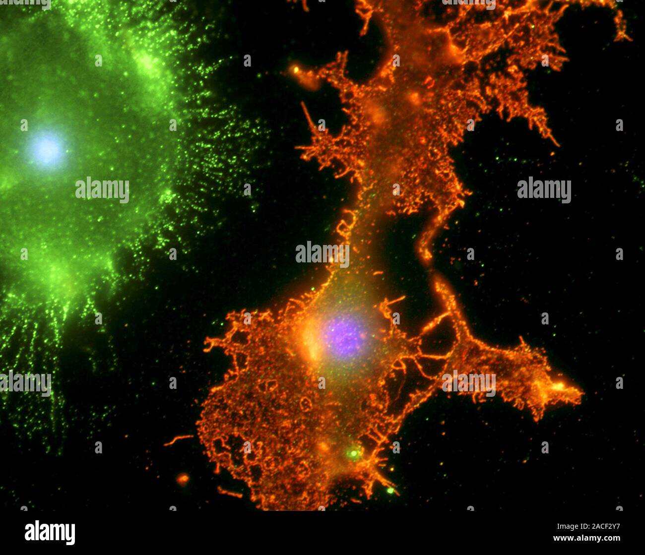 Brain cells in culture. Fluorescent light micrograph of a microglial ...