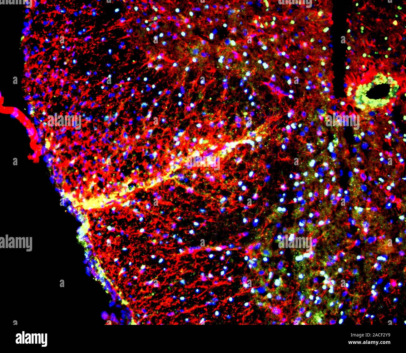 Nerve cell trauma response. Fluorescent light micrograph of a section ...
