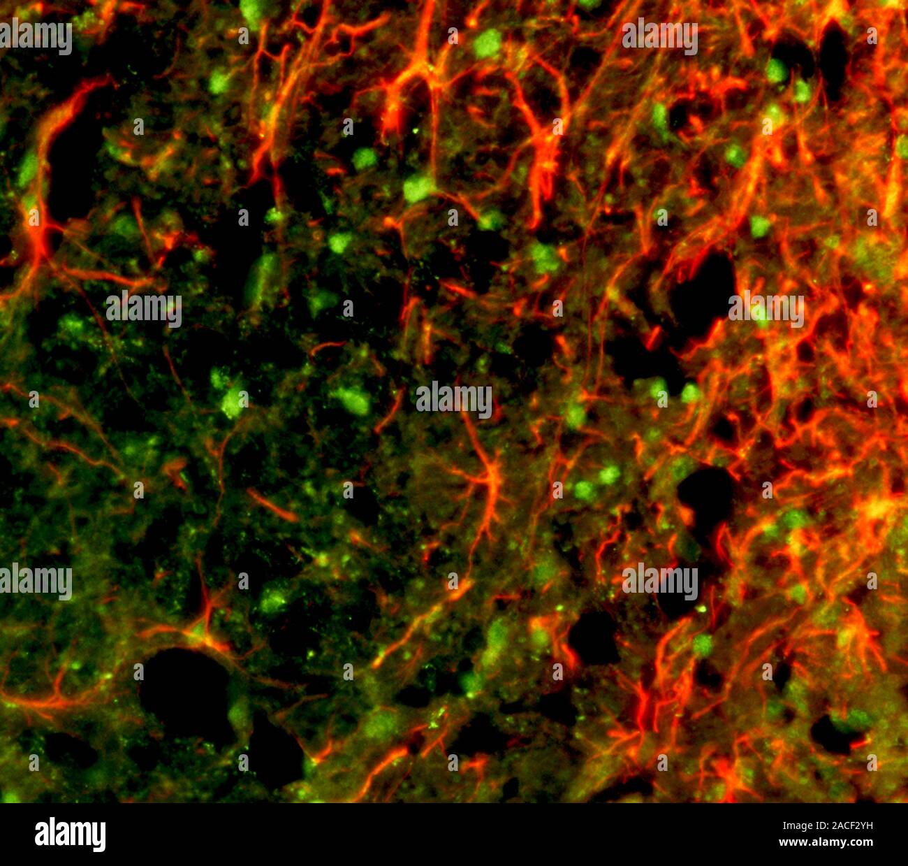 Nerve cell trauma response. Fluorescent light micrograph of a section ...