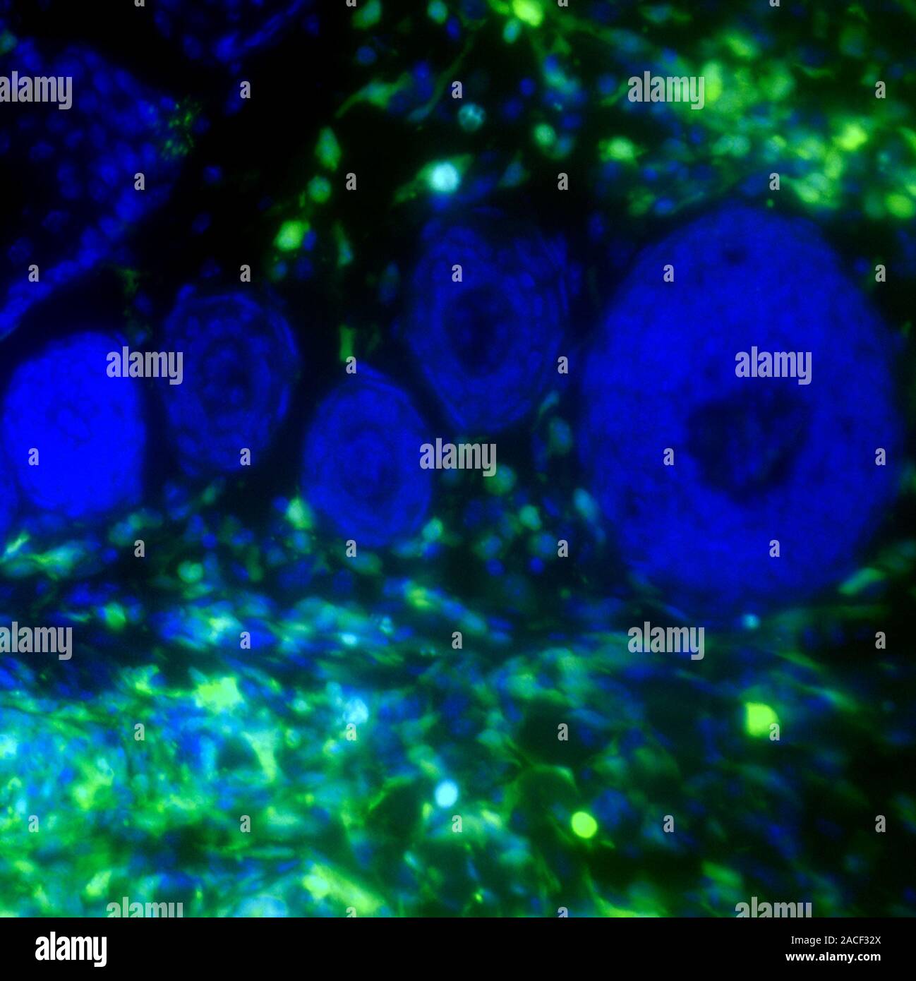 Immune response. Fluorescent light micrograph of monocytes (green ...