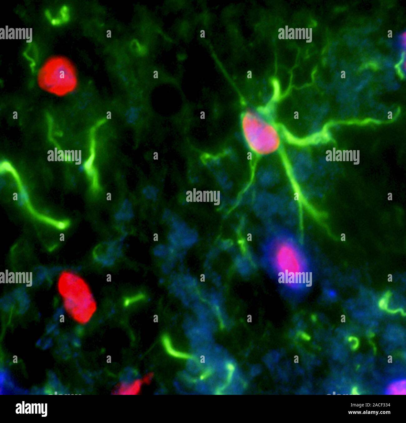 Nerve cell trauma response. Fluorescent light micrograph of a section ...
