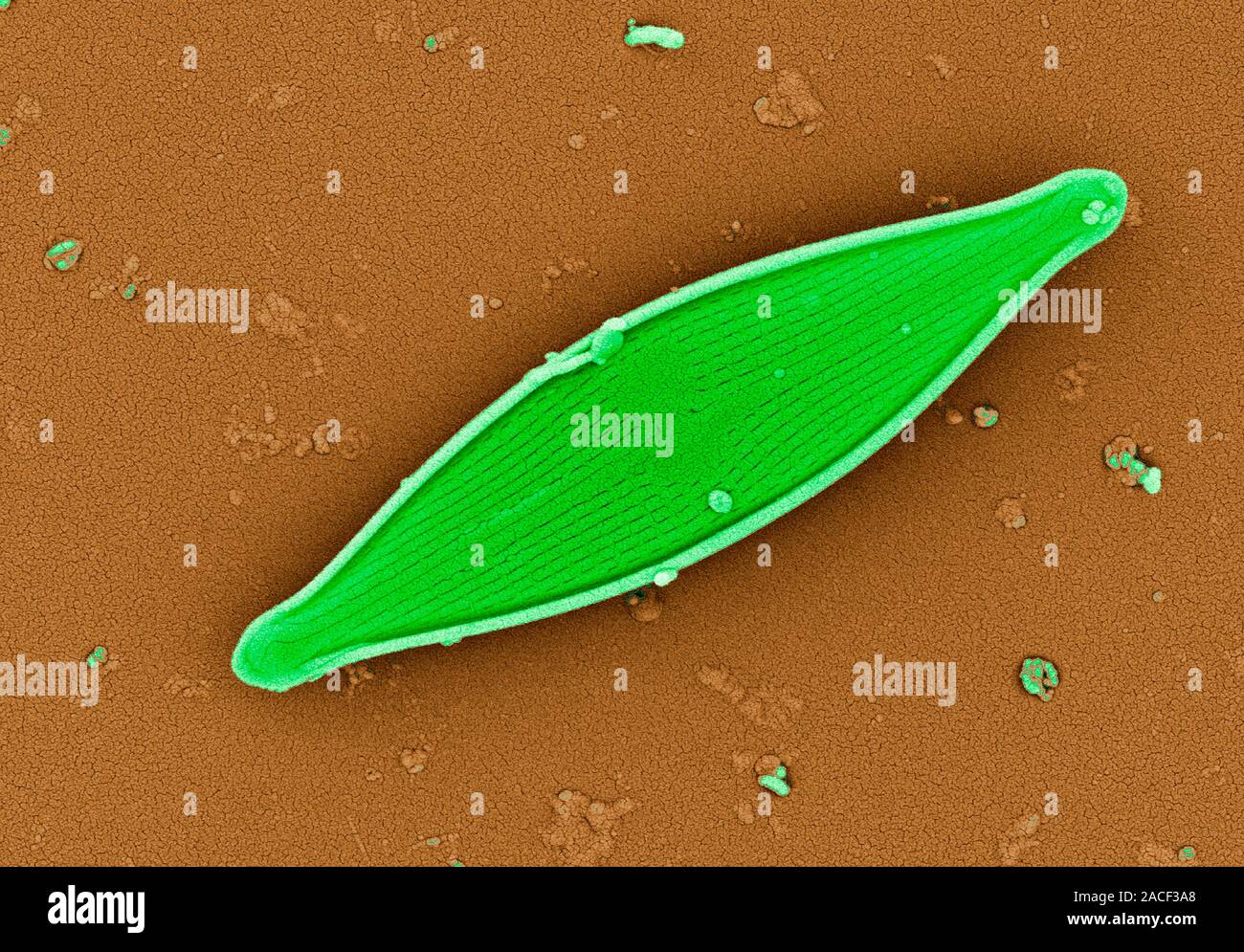 Diatom, coloured scanning electron micrograph (SEM). The diatoms are a ...