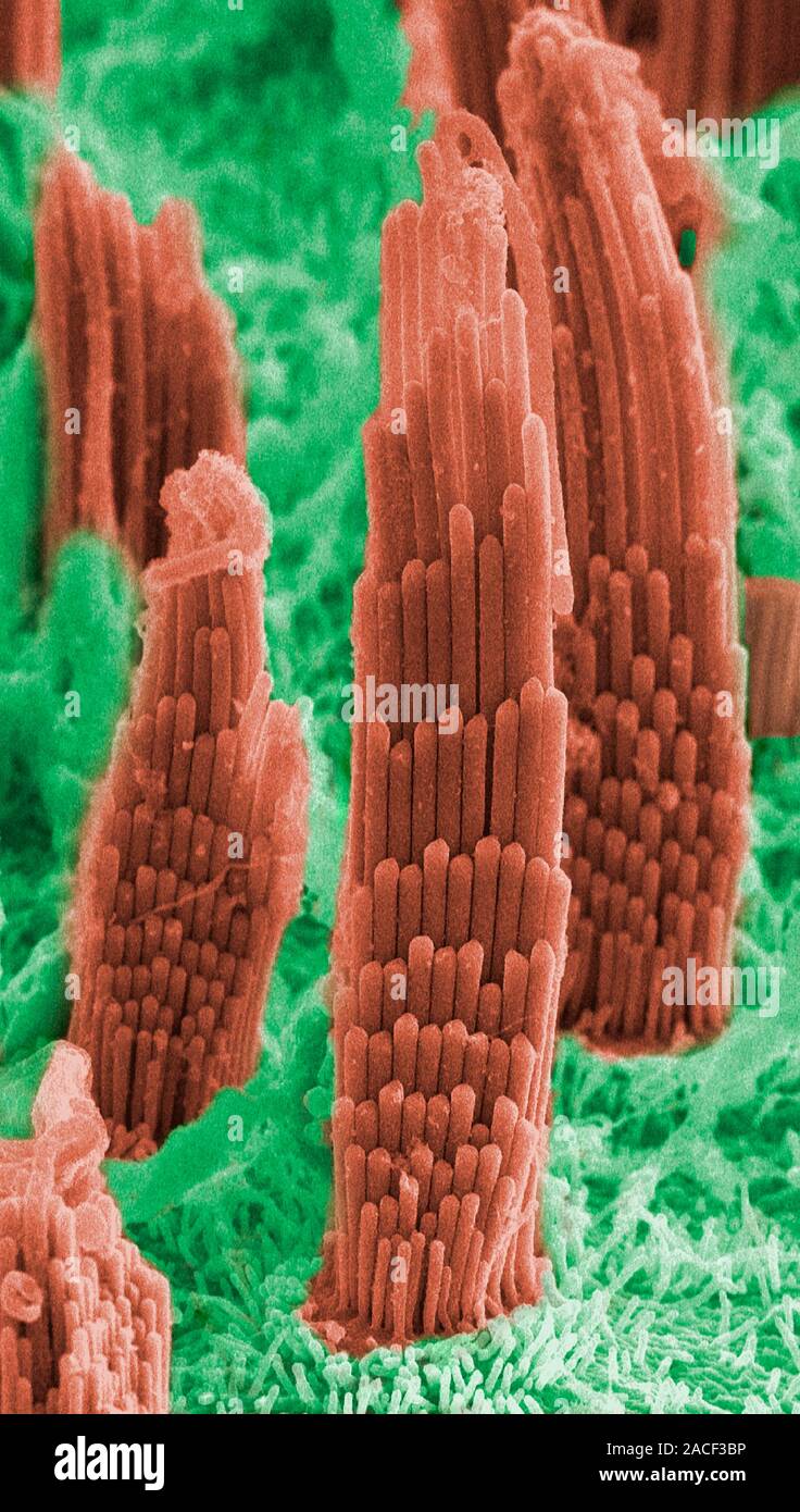 Inner ear hair cells (brown), coloured scanning electron micrograph ...