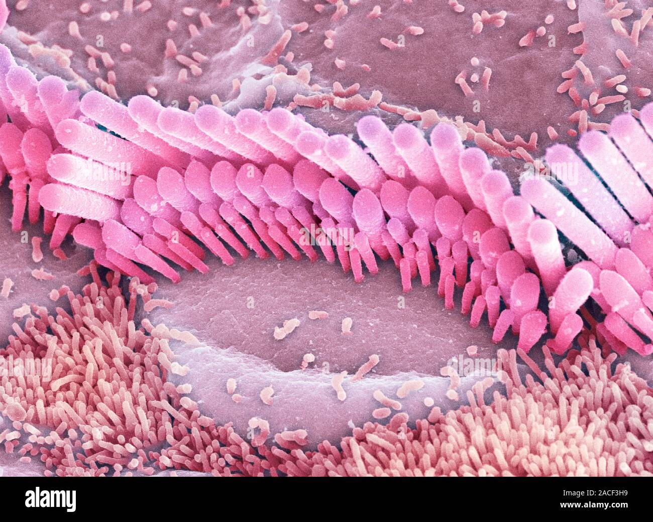 Inner ear hair cells. Coloured scanning electron micrograph (SEM) of ... Inner ear hair cells. Coloured scanning electron micrograph (SEM) of ...